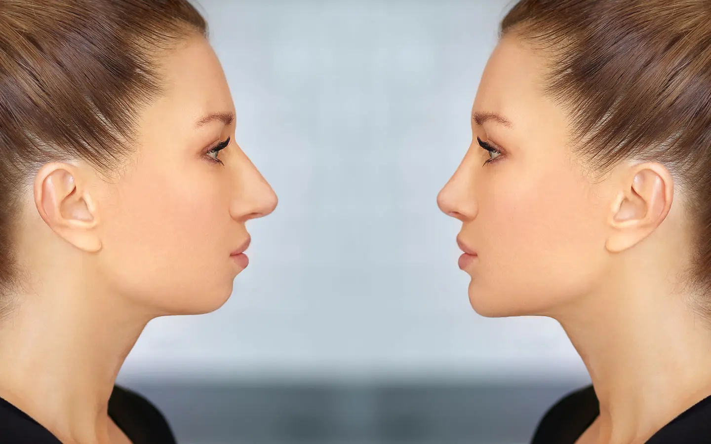 Chin Surgery In Turkey | Affordable Genioplasty