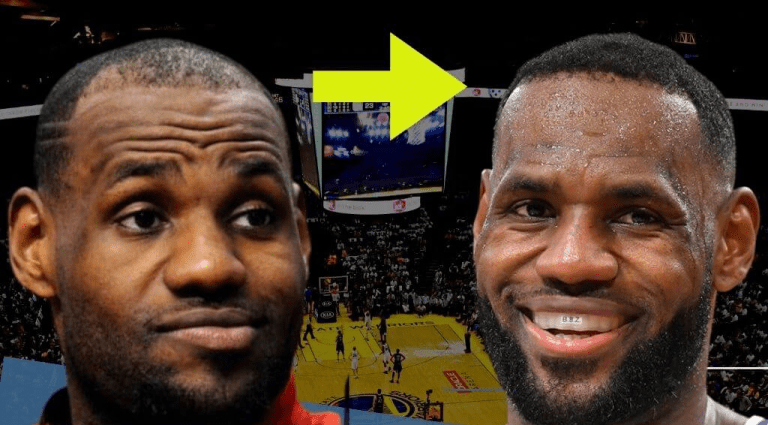 LeBron James Hair Transplant: Did The NBA Superstar Restore His Hairline?