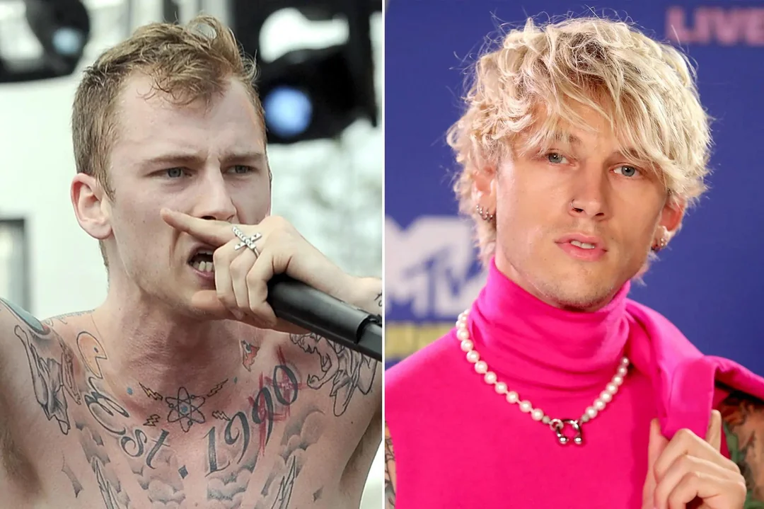 Machine Gun Kelly (MGK) Hair Transplant: The Truth Behind The ...