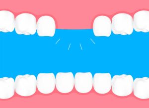 How To Fix Pacifier Teeth: 2 Effective Methods That Work