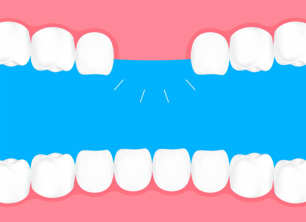 How To Fix Pacifier Teeth: 2 Effective Methods That Work