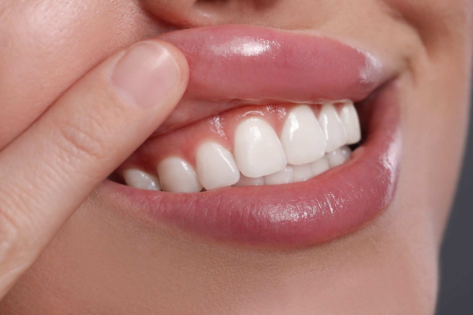 Understanding Inflamed Gums: Symptoms, Causes, And Effective Treatments