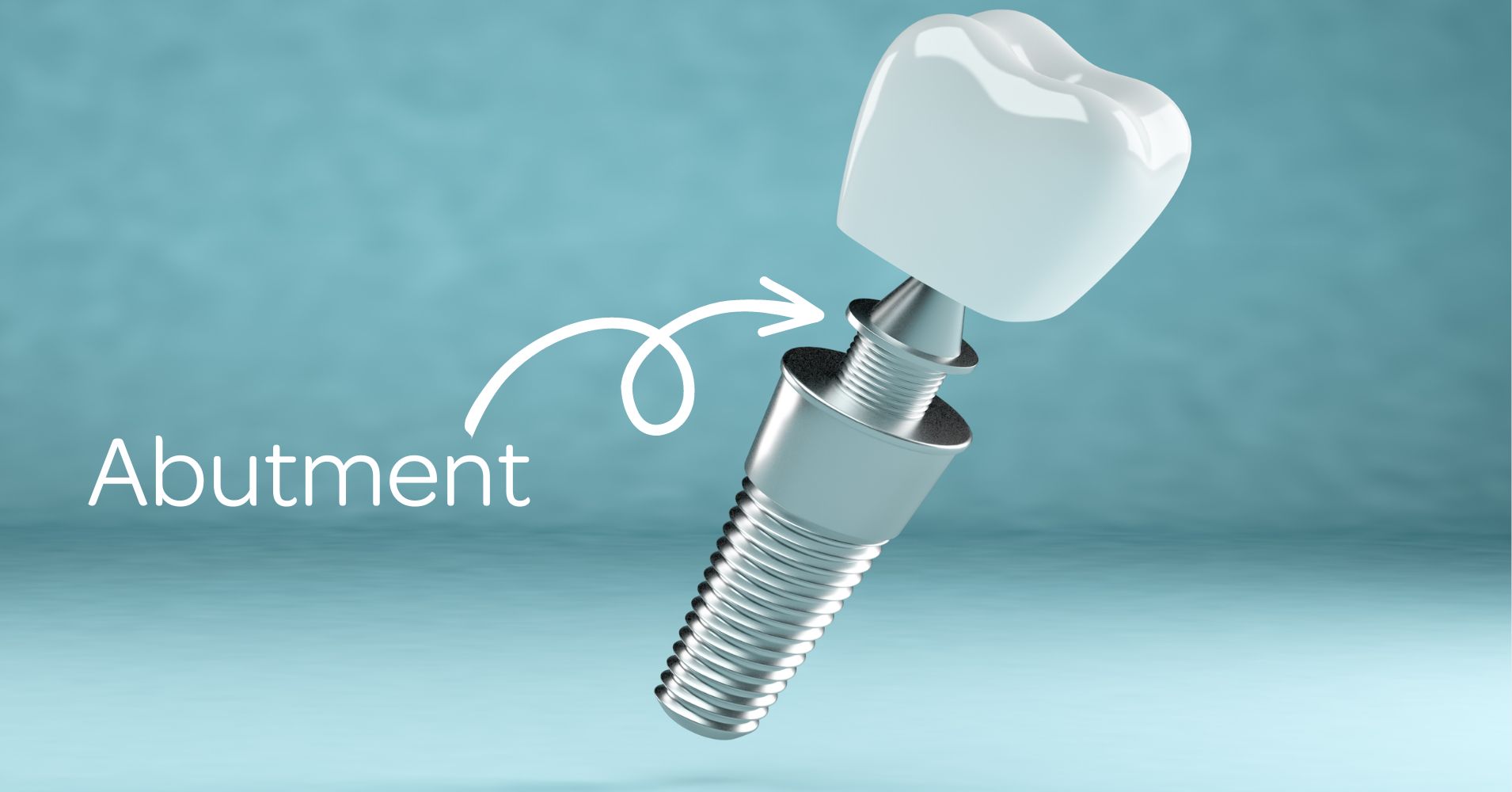 What Is A Dental Implant Abutment? Understanding Its Role And Importance