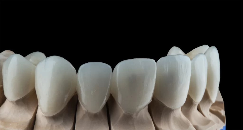 Zirconia Crowns: A Comprehensive Guide